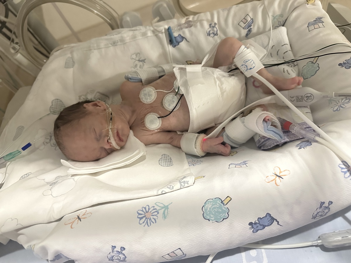 NICU Prem Baby Du Plessis | BackaBuddy
